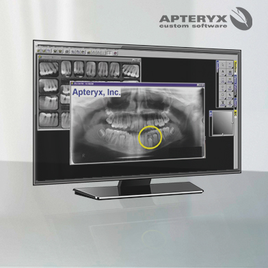 Astra digital radiography